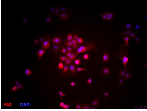 SCC-61 Human Squamous Cell Carcinoma Cell Line | SCC280